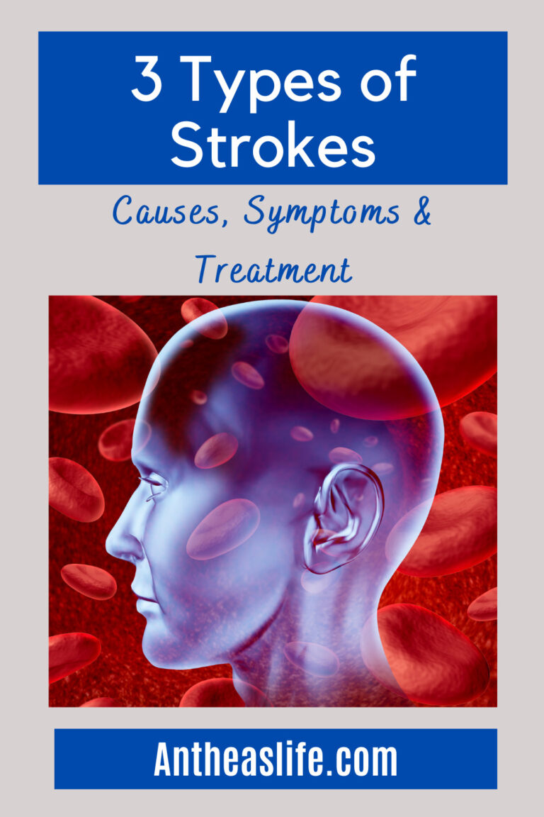 3 Types of Strokes - Causes, Symptoms & Treatment